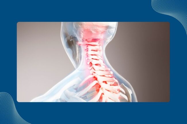Understanding Cervical Spinal Stenosis | Neck Pain